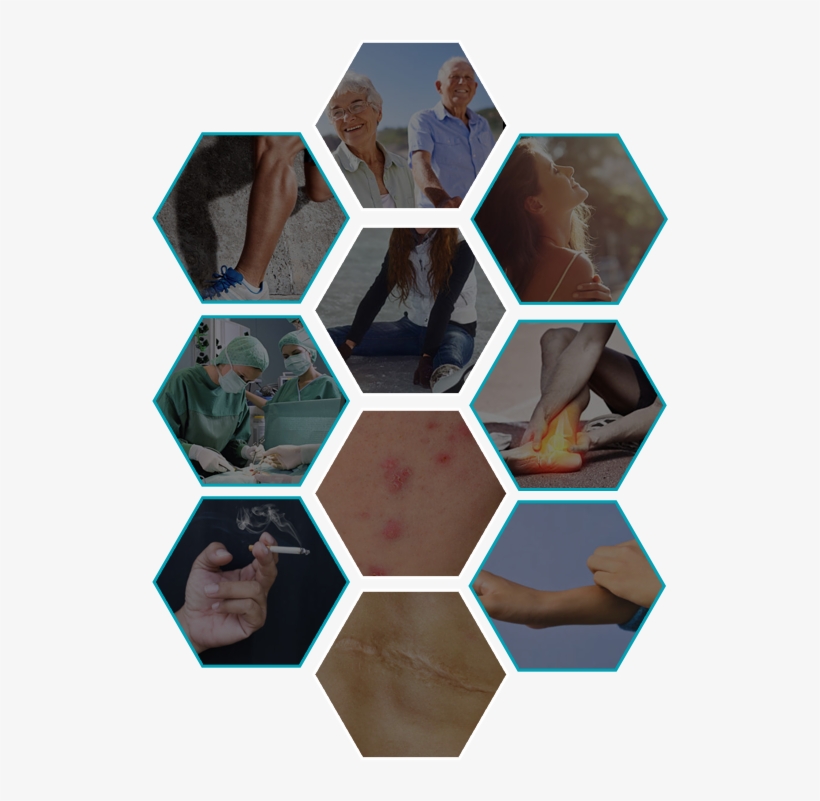 Download Transparent Fine Lines And Wrinkles Causes - Patient Safety ...