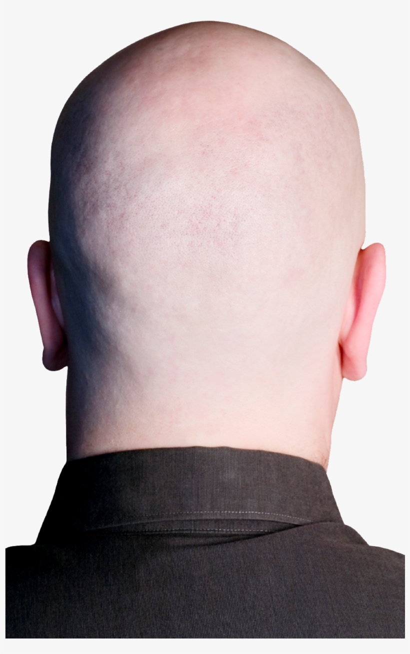 Back Of Head Png - Back Of Bald Head Transparent - 968x1525 PNG ...