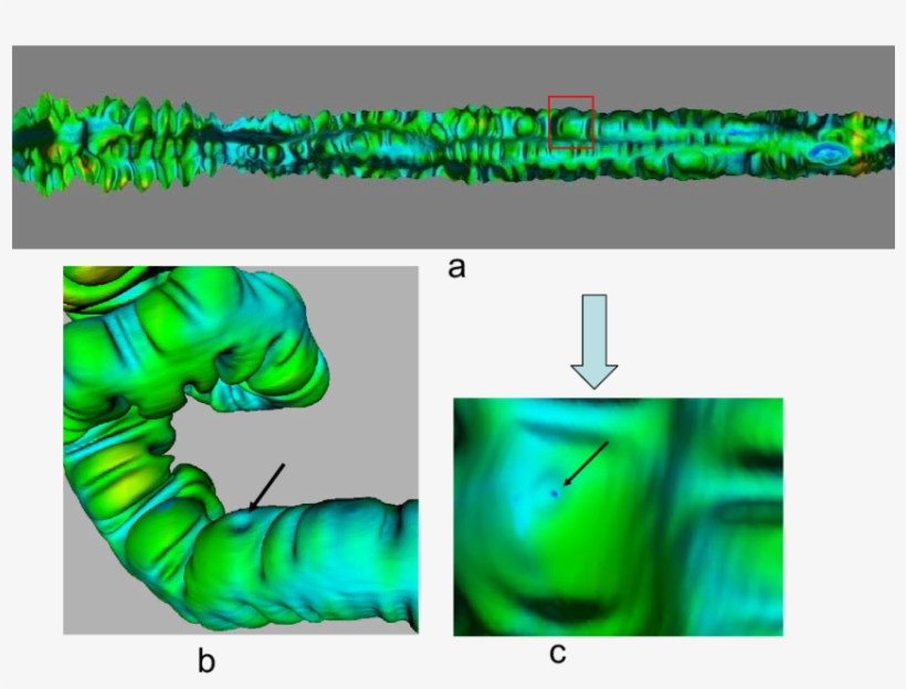 The Part Included In Red Square Indicates The Polyp - Polyp - 850x638 ...
