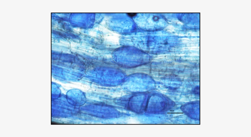 Vesicles In The Roots Of “tiben” Blackcurrant Shrubs - Painting ...