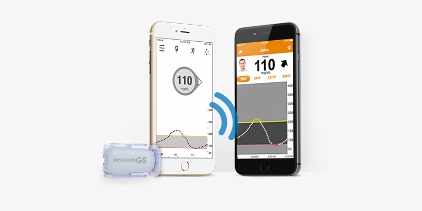 Dexcom G5 Mobile Follow - 454x369 PNG Download - PNGkit