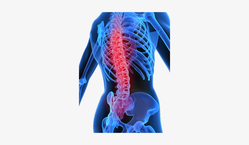 Download Transparent Spinal Injections Safety - Spinal Cord Movmebt ...