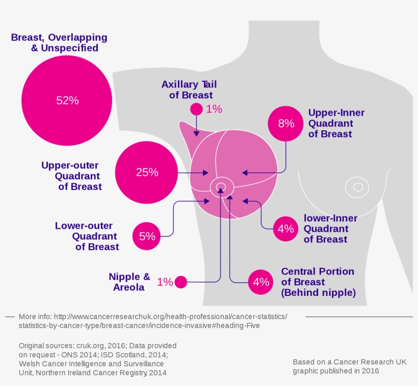 Open - Breast Cancer Overlapping Sites - 2000x1806 PNG Download - PNGkit