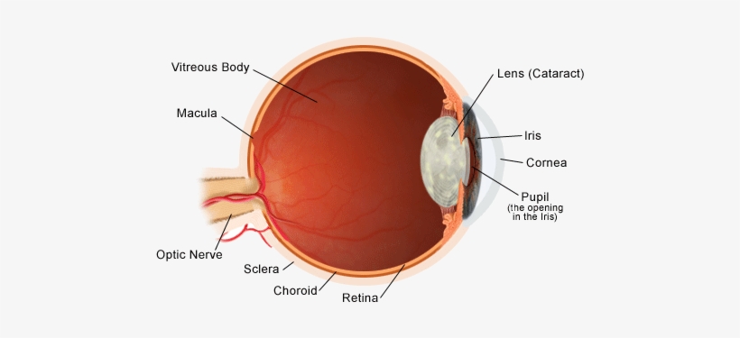 Download Transparent Cataracts - Light Rays Pathway In The Eyeball ...