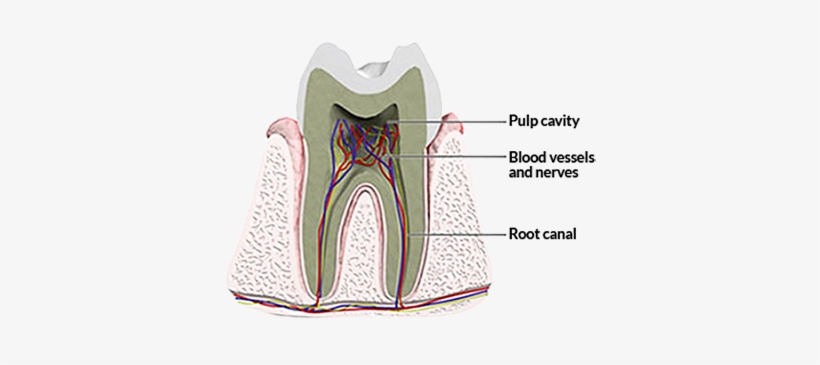 A Root Canal Is A Hollow Area Inside Your Tooth That - Fogfájás ...