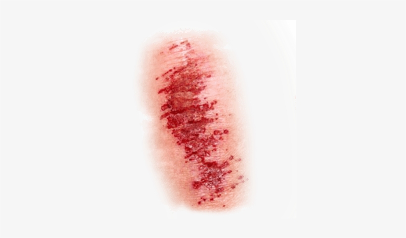 Download Transparent Light Wound - Wound Png - PNGkit