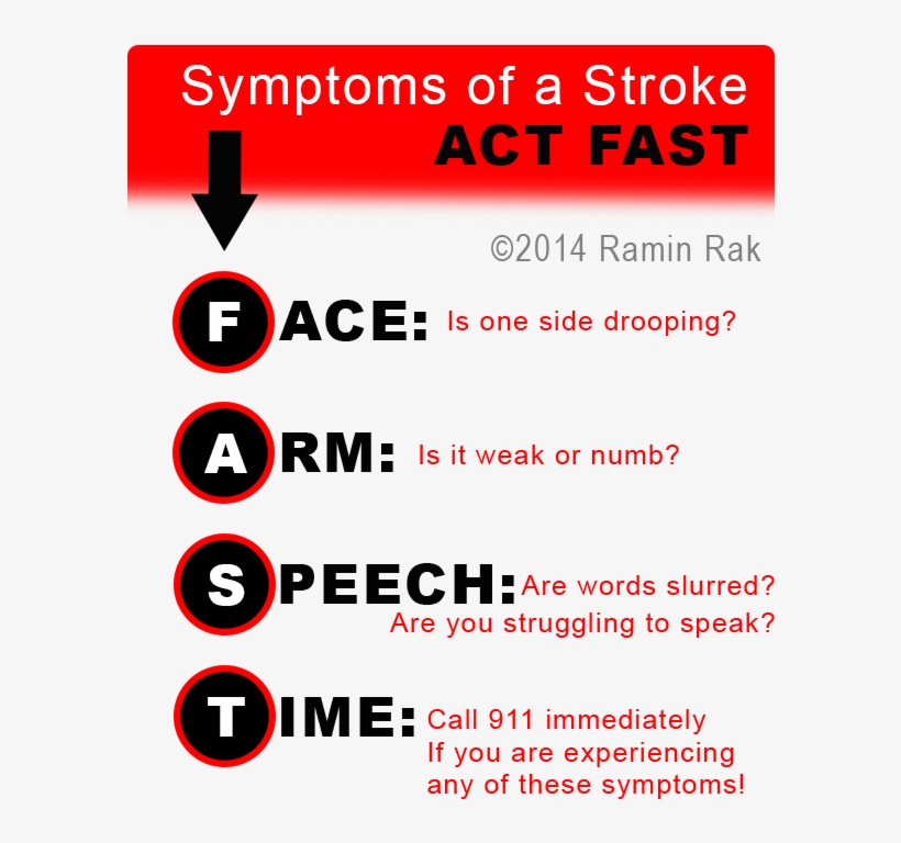 Stroke Symptoms - Mild Stroke Symptoms - 600x722 PNG Download - PNGkit