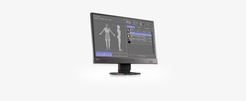 Acquisition And Diagnostic Software For X-ray Images - Computer Monitor ...