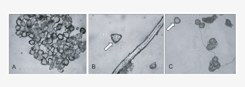 Wind-transported Apple Pollen Grains Observed On Pollen - Visual Arts ...