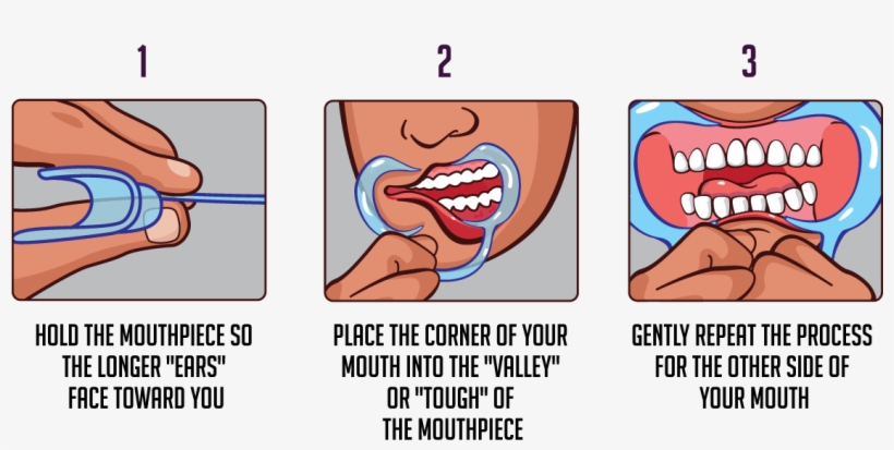 How To Clean Your Mouth Pieces - Watch Your Mouth Instructions ...
