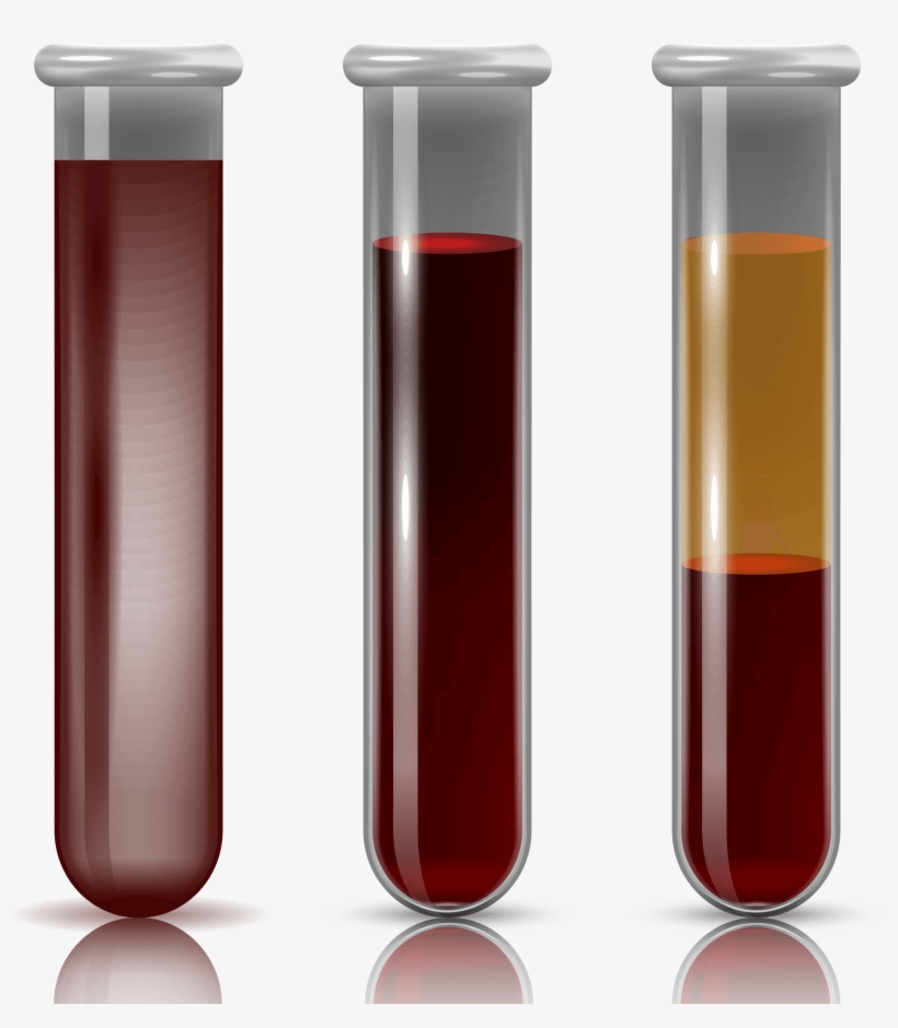 What Is Prp - Intravenous Therapy - 1844x2008 PNG Download - PNGkit