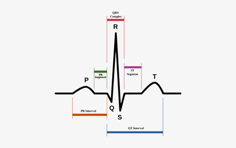 Normal Ecg Lead Ekg Adult Electrocardiogram Reading Look Like ...