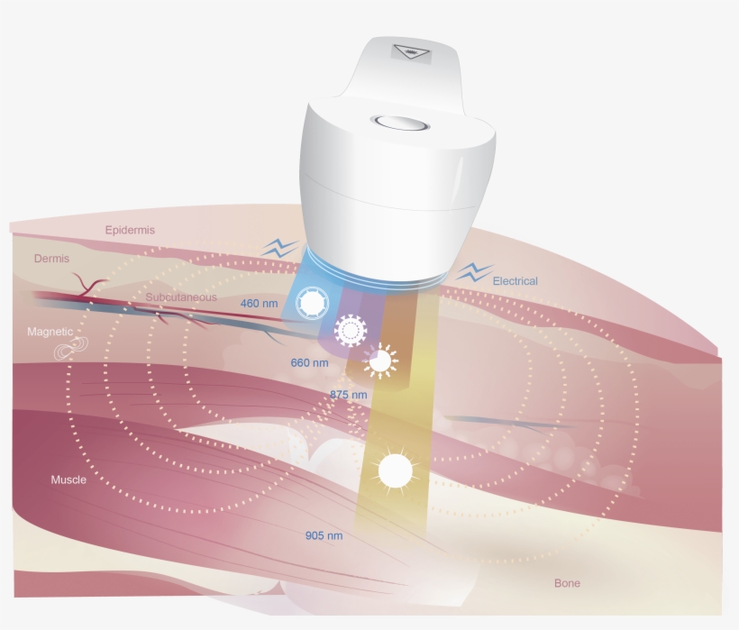 Super Pulsed Laser - Small Appliance - 2701x2570 PNG Download - PNGkit
