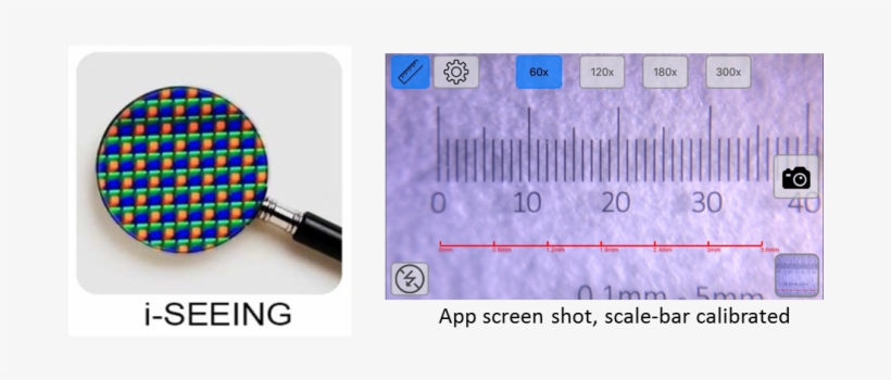 Download Transparent Scale Bar On The Micrograph Could Be Tangled On ...