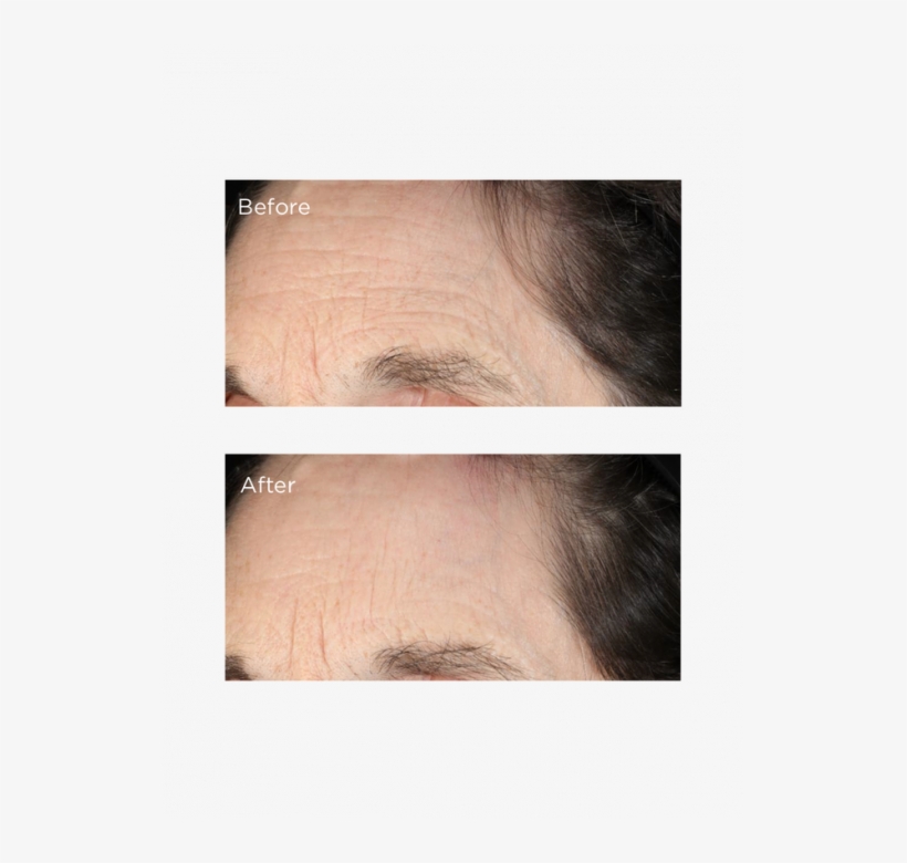 Perricone Md Essential Fx Deep Crease Serum 213119 - Eyelash - 525x700 ...