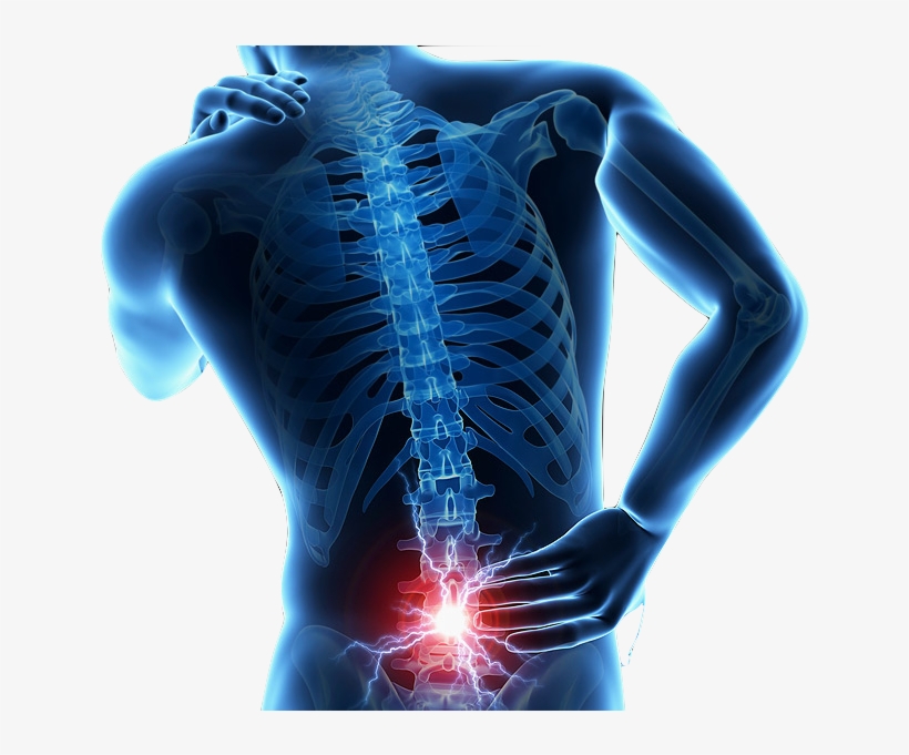 Patriot Back Brace By Corflex - 800x600 PNG Download - PNGkit