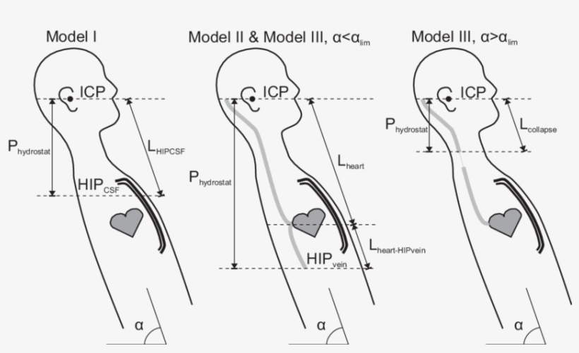 Illustration Of The Three Models Of The Effect Of Posture - Drawing ...