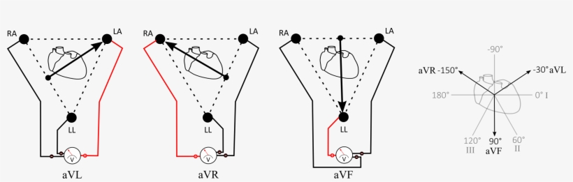 Graphic Royalty Free Download Natalies Casebook Tag - Avl Avr Avf ...