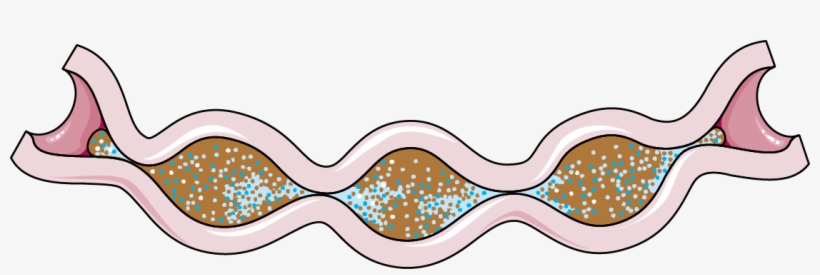 Intestine Segmentation - 1120x321 PNG Download - PNGkit