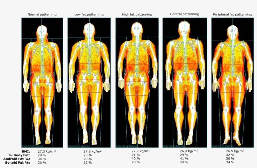 Figure 6 Fat - 3 Kg Of Fat - 1382x840 PNG Download - PNGkit