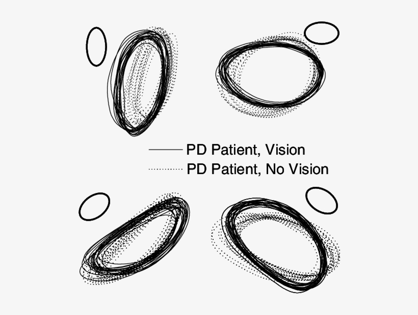 An Example Of Drawing The Four Oval Shapes By A Pd - Shape - 516x537 ...