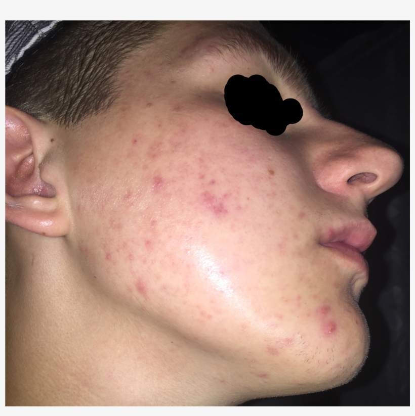 Pic 1 - No Expression - 2448x3264 PNG Download - PNGkit