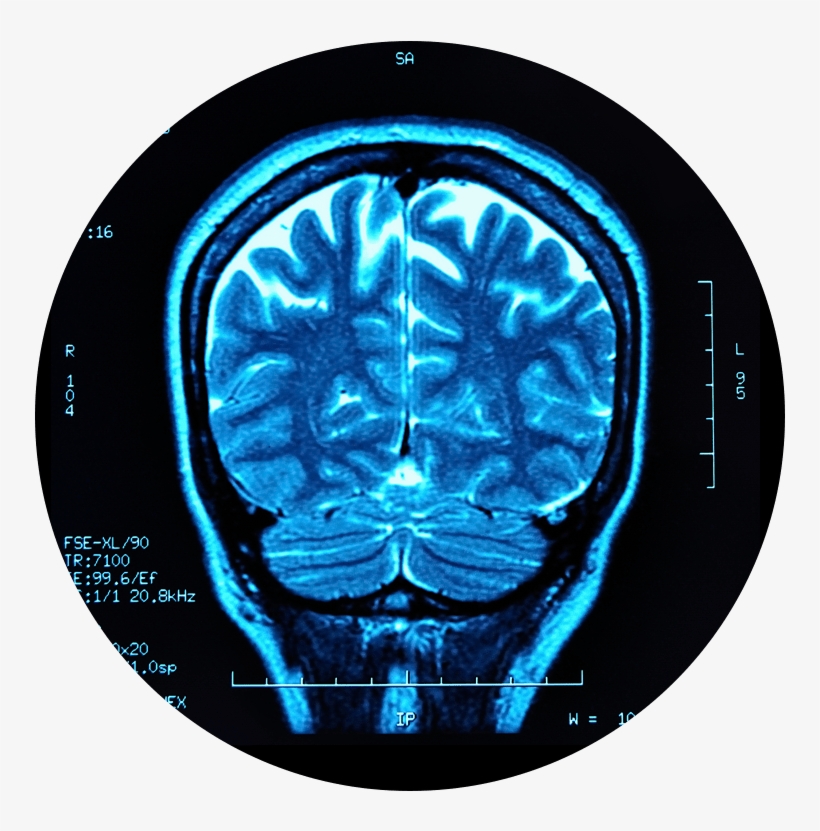 Traumatic Brain Injury - 800x800 PNG Download - PNGkit