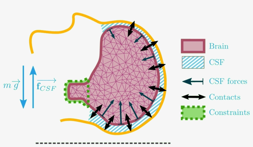 Patient-specific Biomechanical Simulation For Deep - Diagram - 1000x523 ...