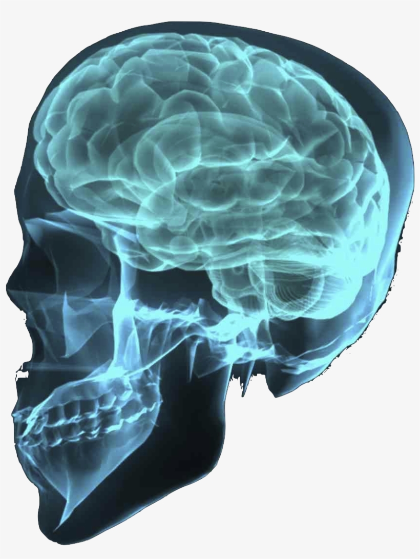 X-ray Png Transparent Image - Brain X Ray Transparent - 943x1149 PNG ...