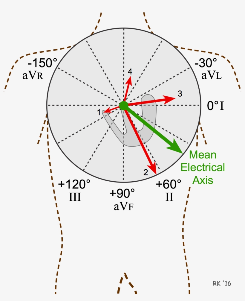 Ecg Electrical Mean Axis Diagram 1170x1379 Png Download Pngkit
