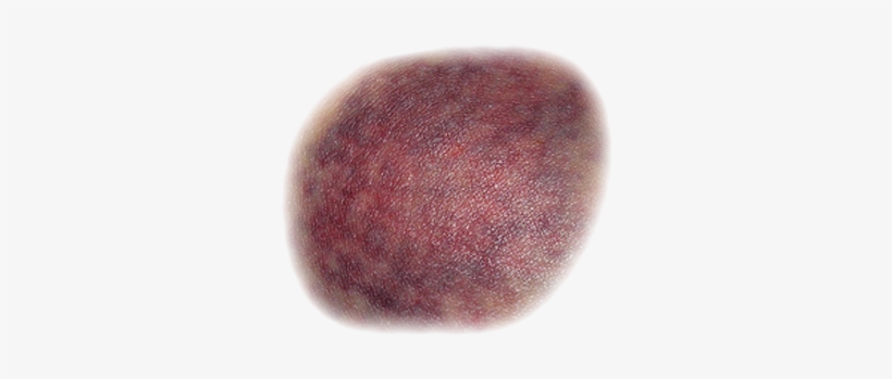 Download Transparent Best Of Boston Background Psd Detail Bruise ...