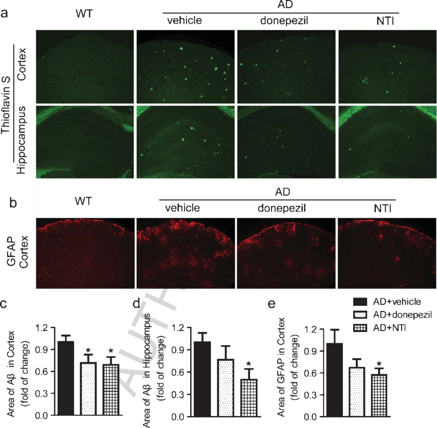 Download Pathological Analysis Of The Brain Sections From App/ps1 ...