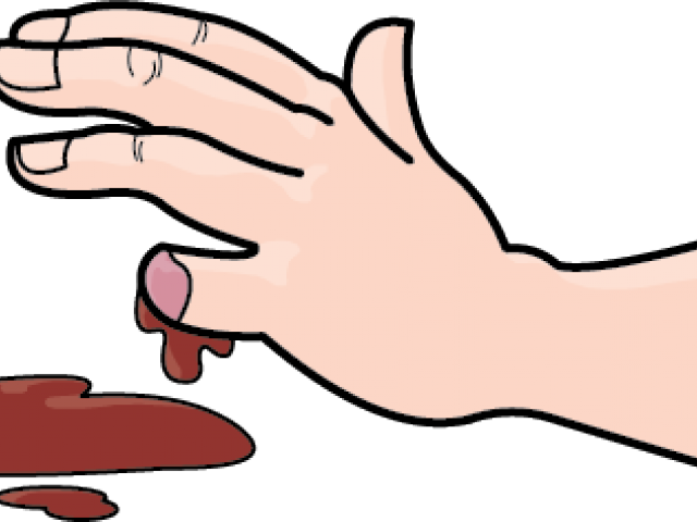Download Wound Clipart Bleeding Kansas - Bleeding - Full Size PNG Image ...