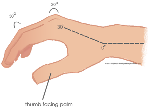 Download Loss Of Use Of The Fingers - Hand Function Percentage Finger ...