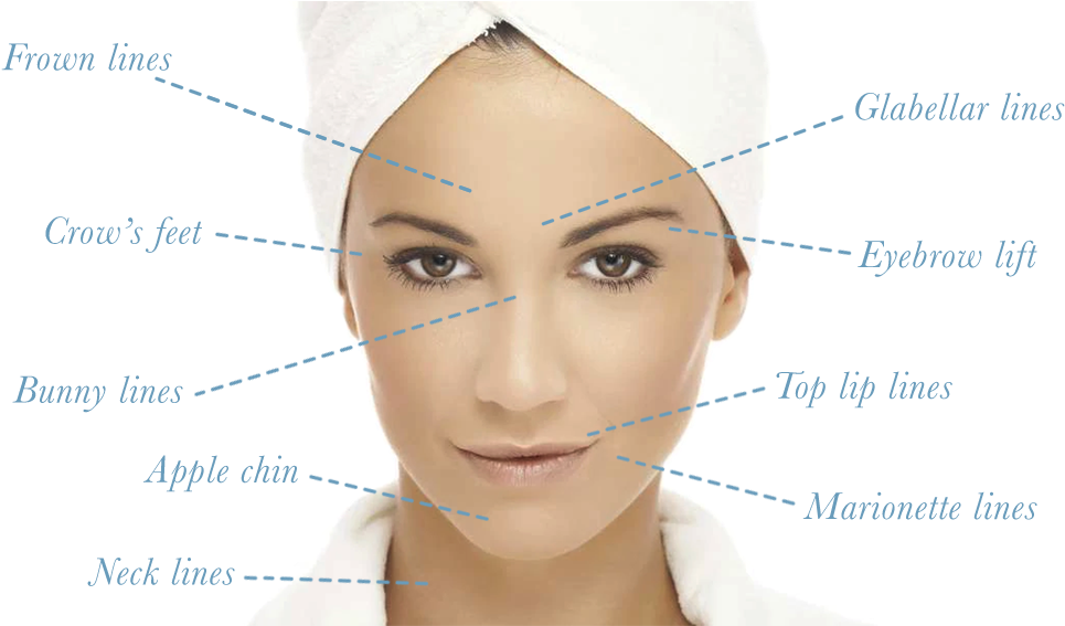 Download Dysport Facial Lines - Aspen Naturals Shea Butter Ivory Ultra ...