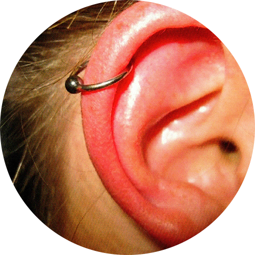 Download Helix Piercing - My Cartilage Piercing Infected - Full Size ...