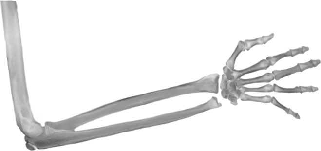 Download Xray Of Full Arm - Full Size PNG Image - PNGkit