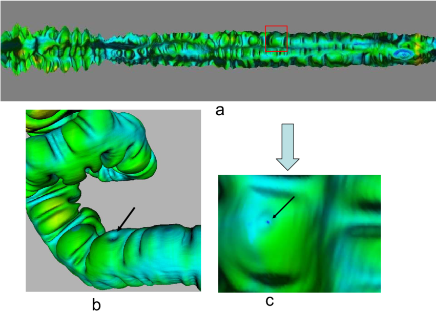 Download The Part Included In Red Square Indicates The Polyp - Polyp ...