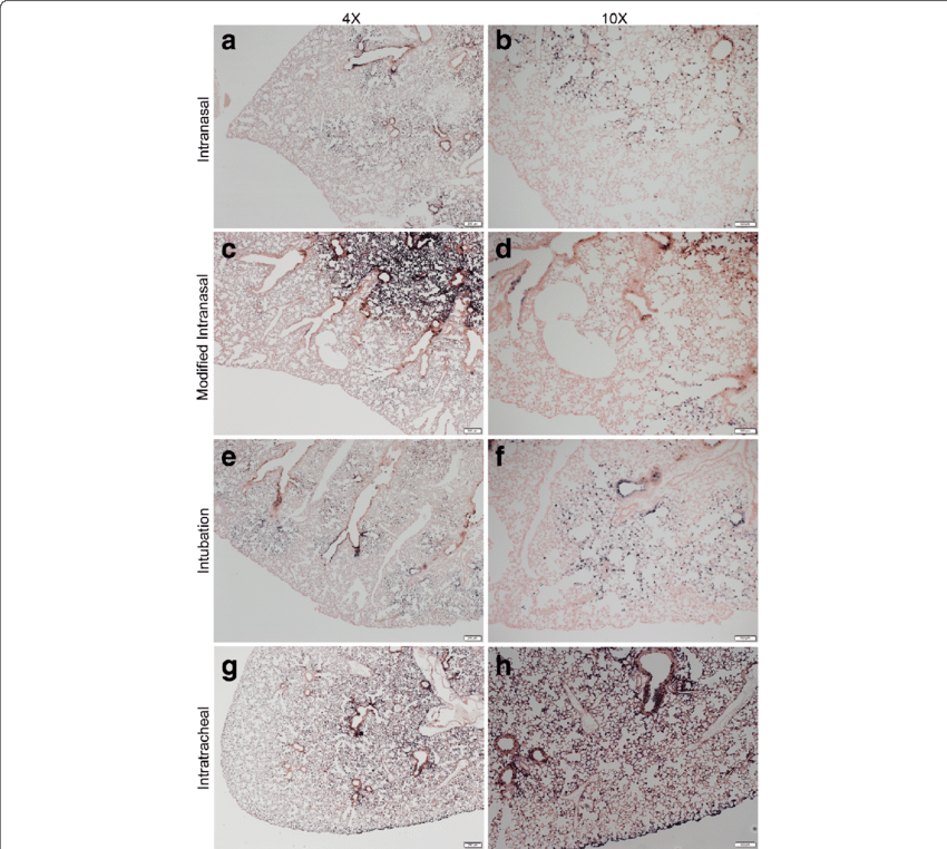 Download Histological Analysis Of Alkaline Phosphatase Staining ...