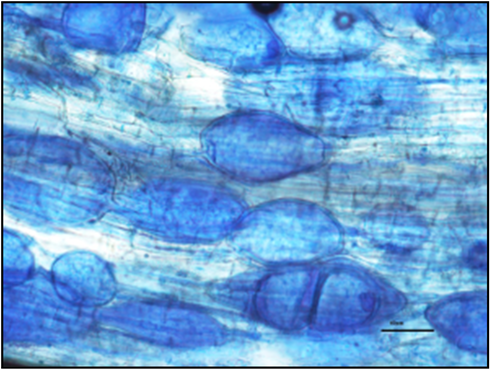 Download Vesicles In The Roots Of “tiben” Blackcurrant Shrubs ...