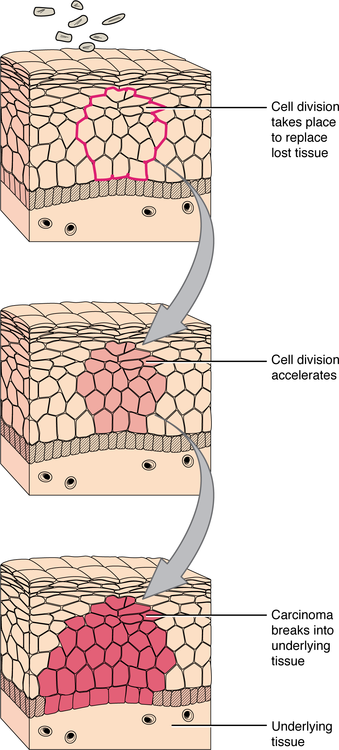 Download 418 Development Of Cancer - Tissue Cell Diagram - Full Size ...