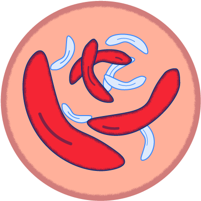 Download Sickle Cell Resources - Linterna Verde - Full Size PNG Image ...