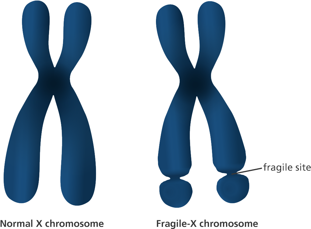 Download An Illustration Showing The Appearance Of Normal And - Fragile ...