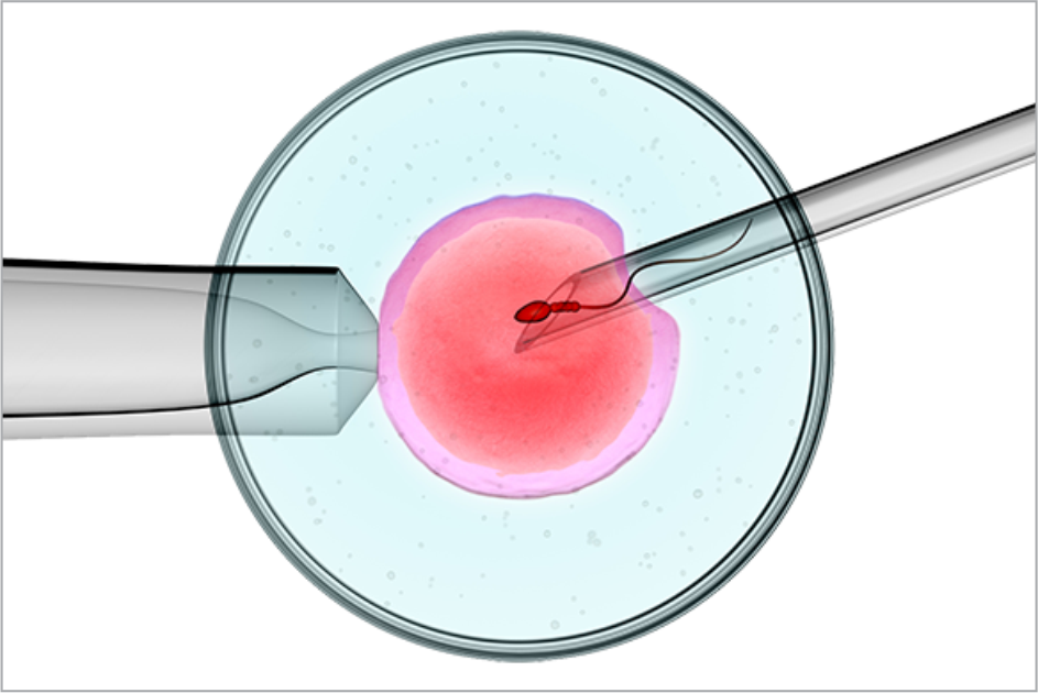 Download Deepam Fertility Centre Is Functioning As A Separate - Ivf ...