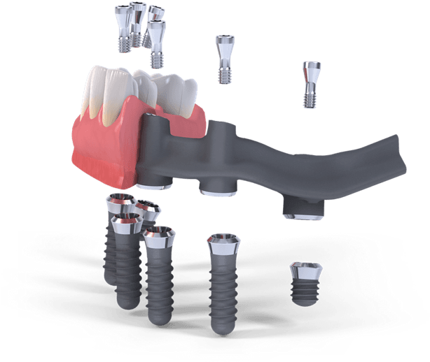 Download Straumann Pro Arch - Full Size PNG Image - PNGkit