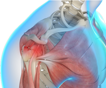 Download Rotator Cuff - Boise - Full Size PNG Image - PNGkit