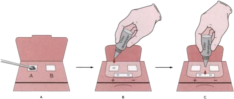 Download Fecal Occult Blood Test - Guaiac Test Steps - Full Size PNG ...