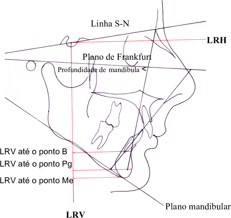 Download Linhas De Referência Vertical Lrv E Horizontal Lrh, - Diagram ...