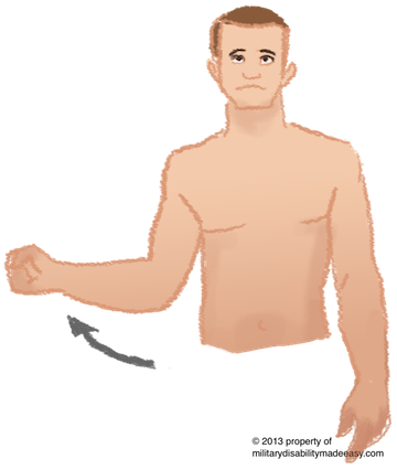 Download Upper Nerve 32 - Arm Disability - Full Size PNG Image - PNGkit