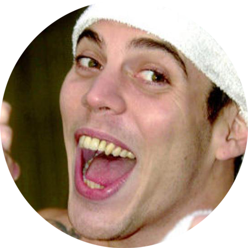 Download Steve-o - Steve O Before And After - Full Size PNG Image - PNGkit